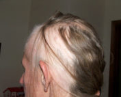 Welcome ThyroSisters - Home of the Thyroid MVP Program!