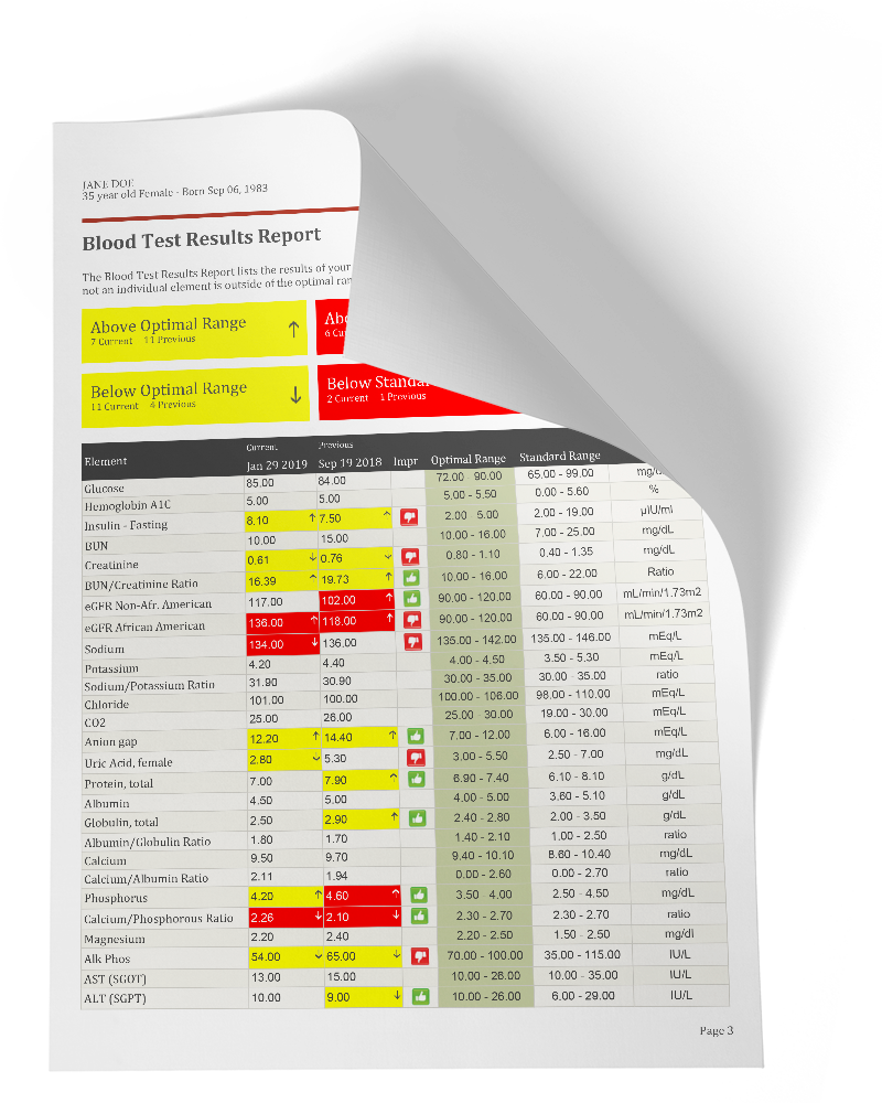 Thyroid Lab Work & Blood Panels - ThyroSisters™